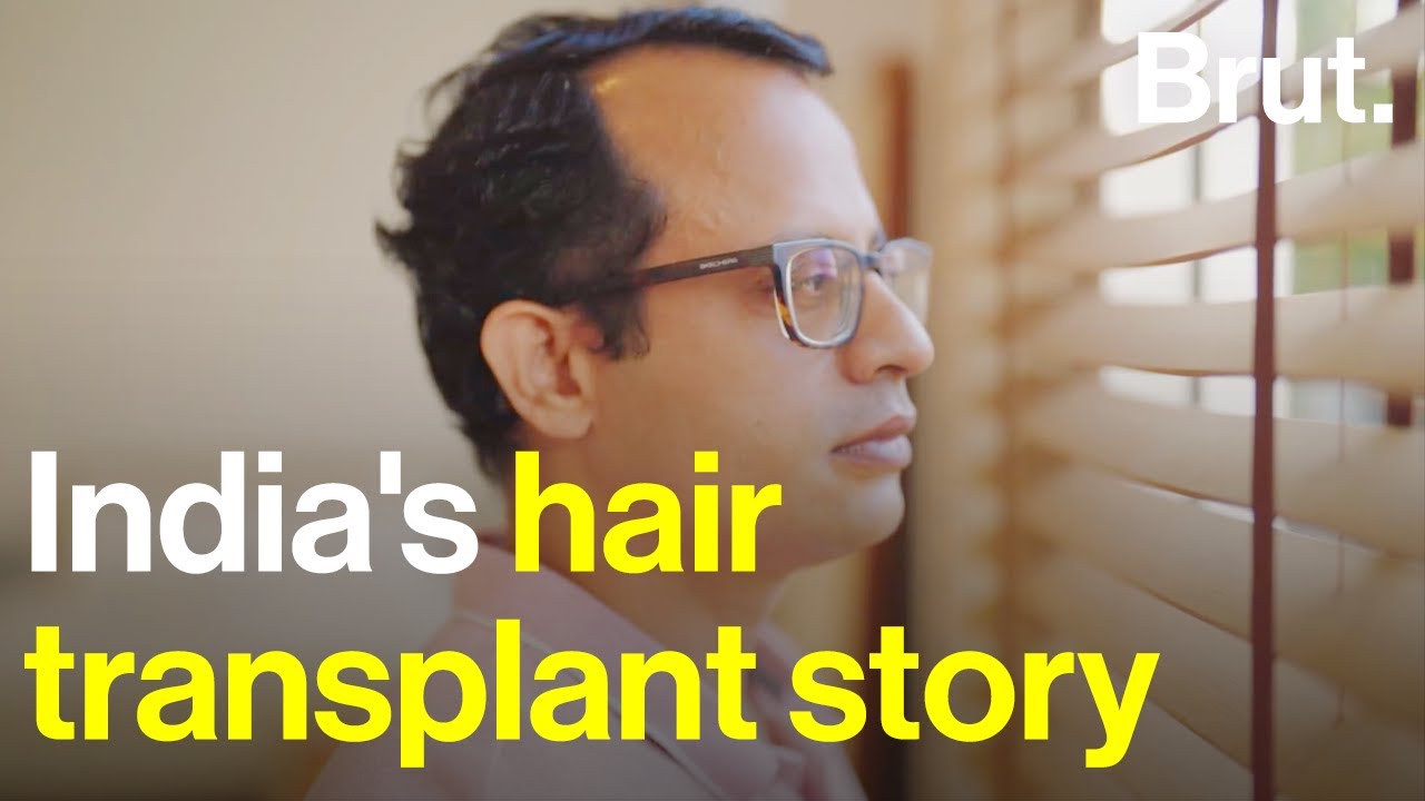 Why are Indian men turning bald? | In collaboration with Eugenix - YouTube