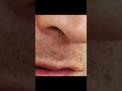 Зачем нам волосы в носу? - YouTube
