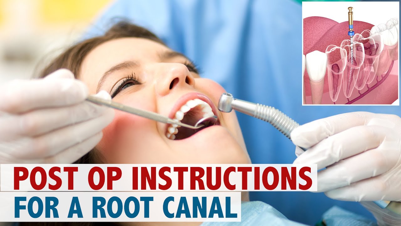Post Op Instructions for a Root Canal - YouTube