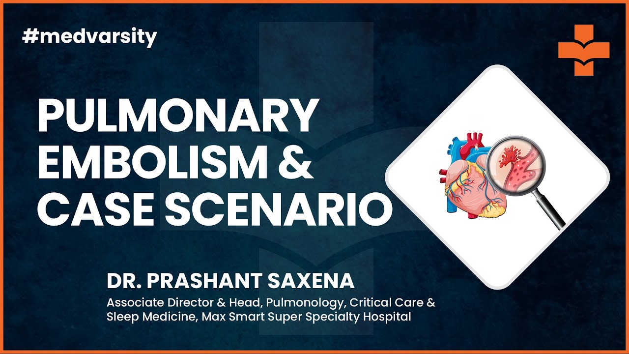 Case Discussion: Pulmonary Embolism & Case Scenario ...