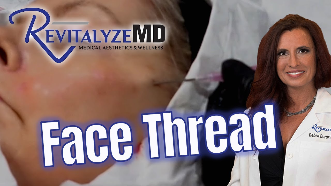 What is a Face Threadlift?Learn more about it & how you can have your ...
