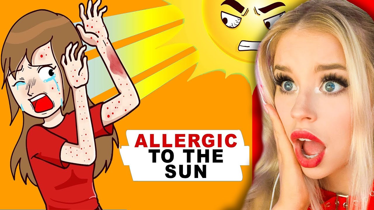 I Am Allergic To The Sun - YouTube