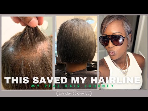 From Thin to Thick Hair FAST!  💇🏾‍♀️  | Tricia Bachoo
