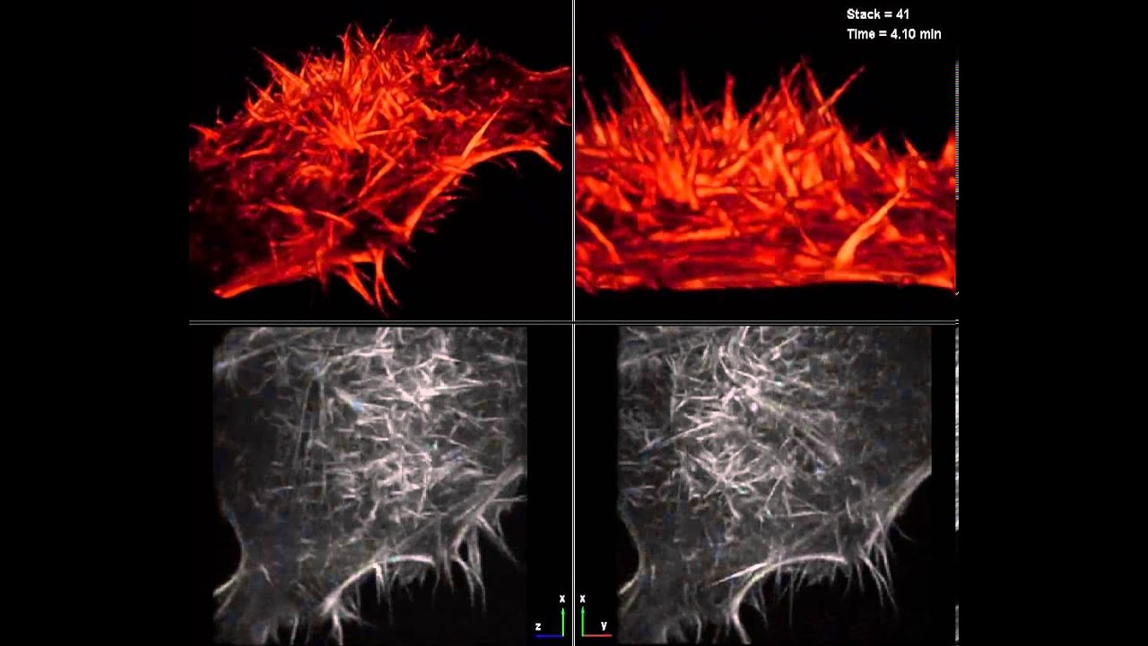 Narrated: Filopodia Waving on the Surface of a HeLa Cell - YouTube