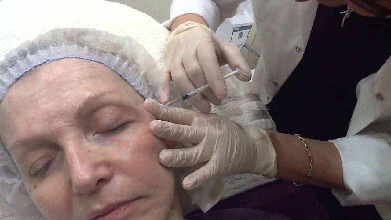 Botox UK Treatment in Droitwich, Worcestershire at Outline Skincare ...