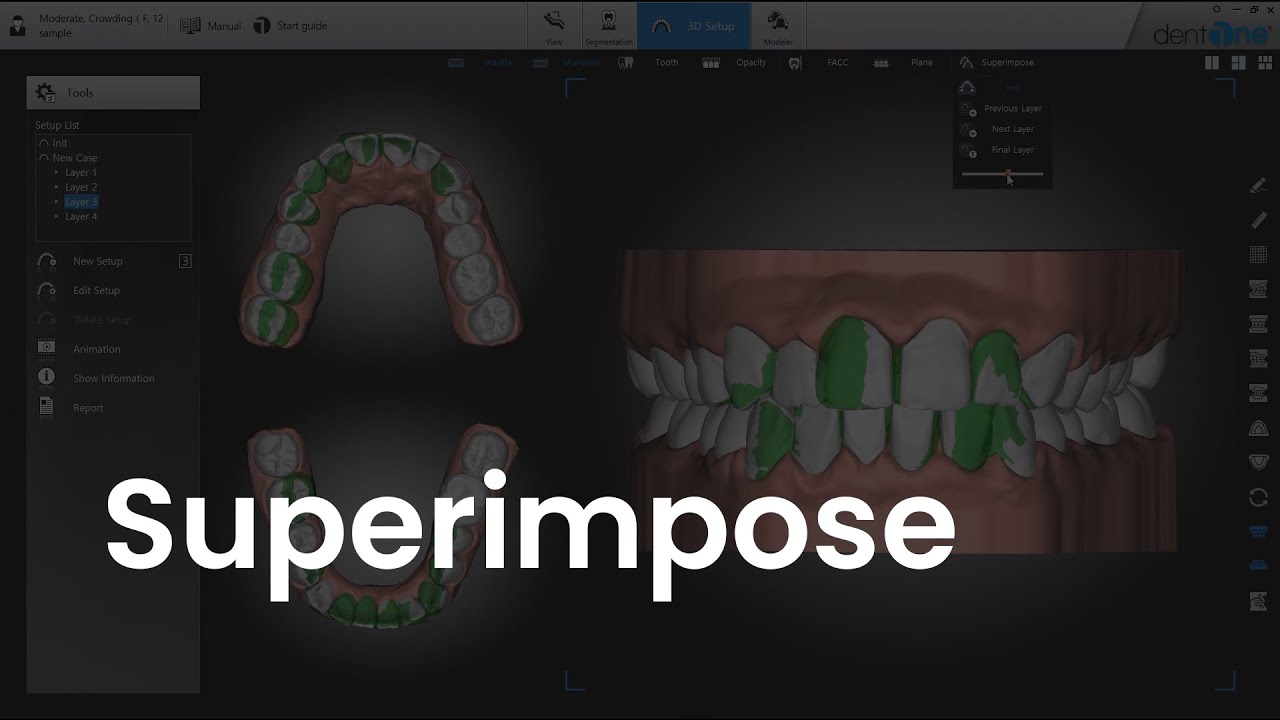 Superimpose - YouTube