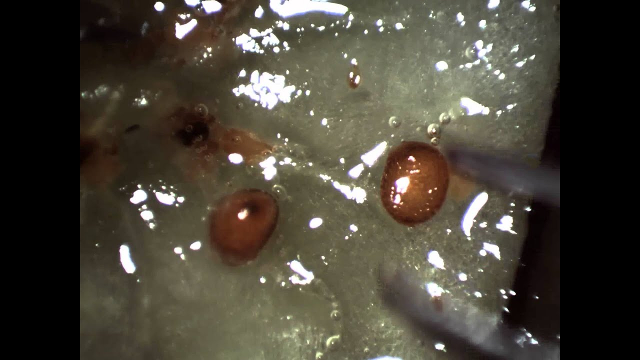 Inspecting a blueberry (and seed) with a stereo microscope, about 90X ...