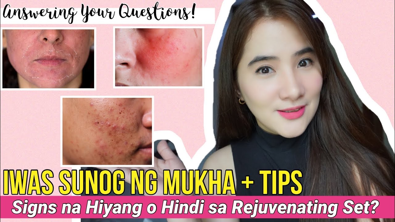 IWAS SUNOG TIPS + SIGNS NA HINDI KA HIYANG sa REJUVENATING SET | IWAS ...