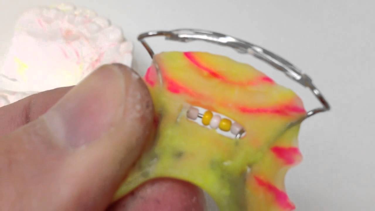 Bluegrass attachment spinner beads in a retainer - YouTube