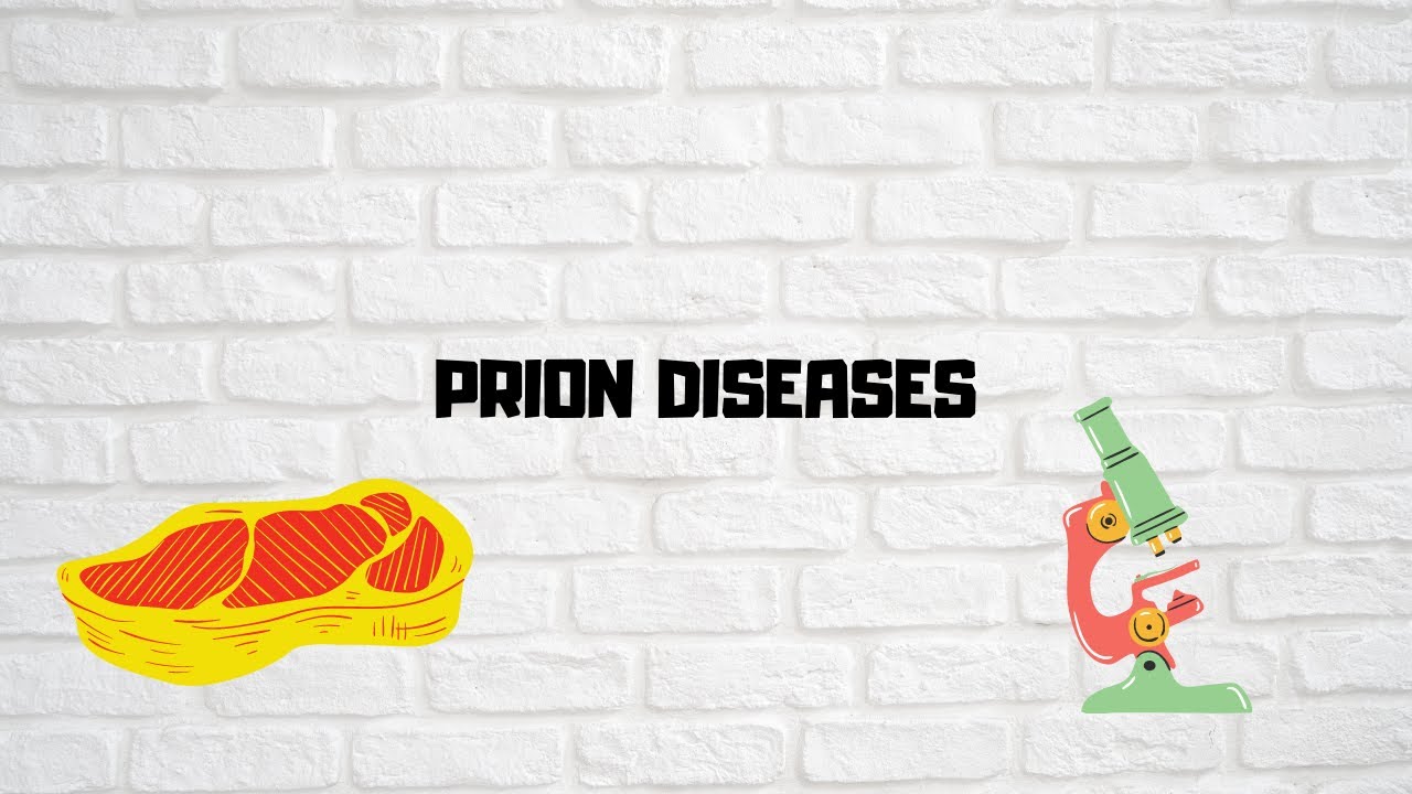 Prions | Prion diseases in humans | Epidemiology | Pathology | Clinical ...