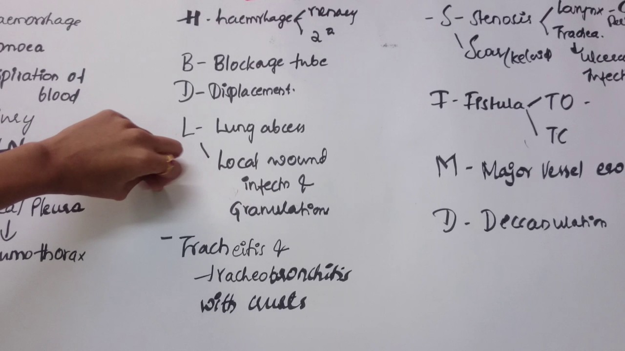 Tracheostomy Complications With Mnemonic Youtube