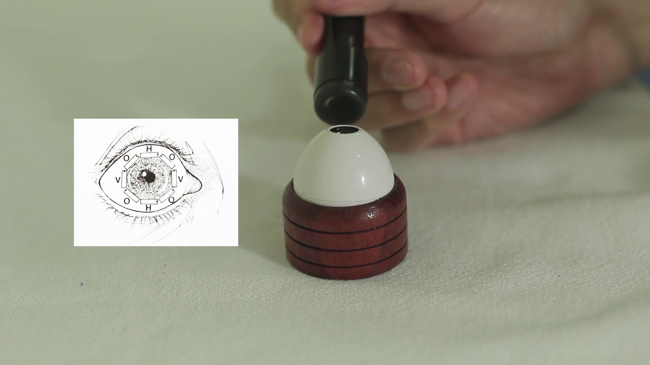 PEMERIKSAAN USG MATA - YouTube