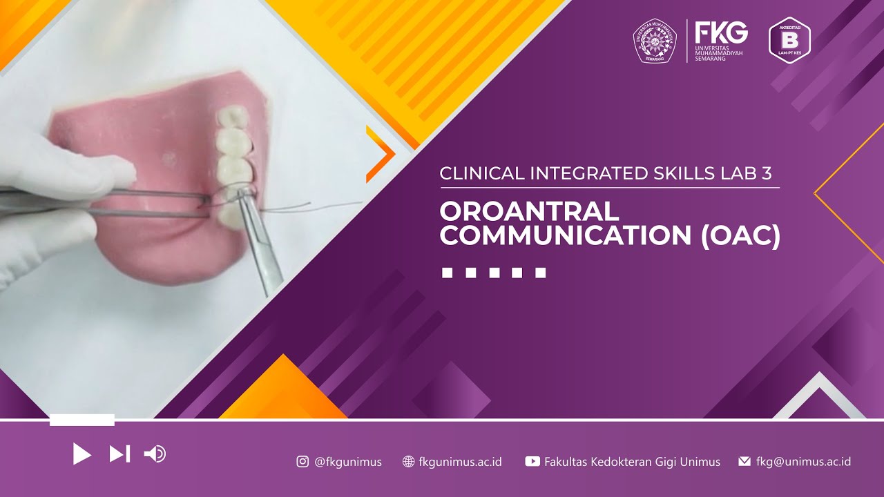 Clinical Integrated Skills Lab 3 - OROANTRAL COMMUNICATION (OAC) - YouTube