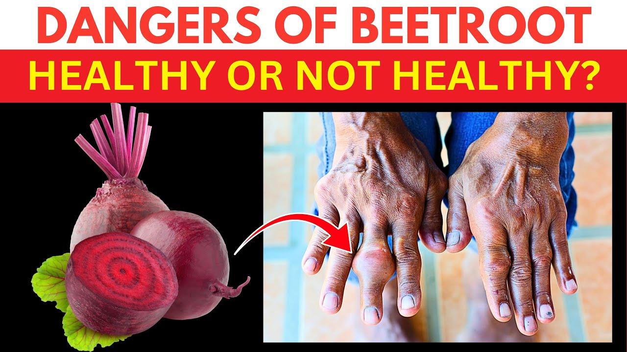 The Dark Side of Beetroot: 8 Shocking Side Effects (not what you think ...