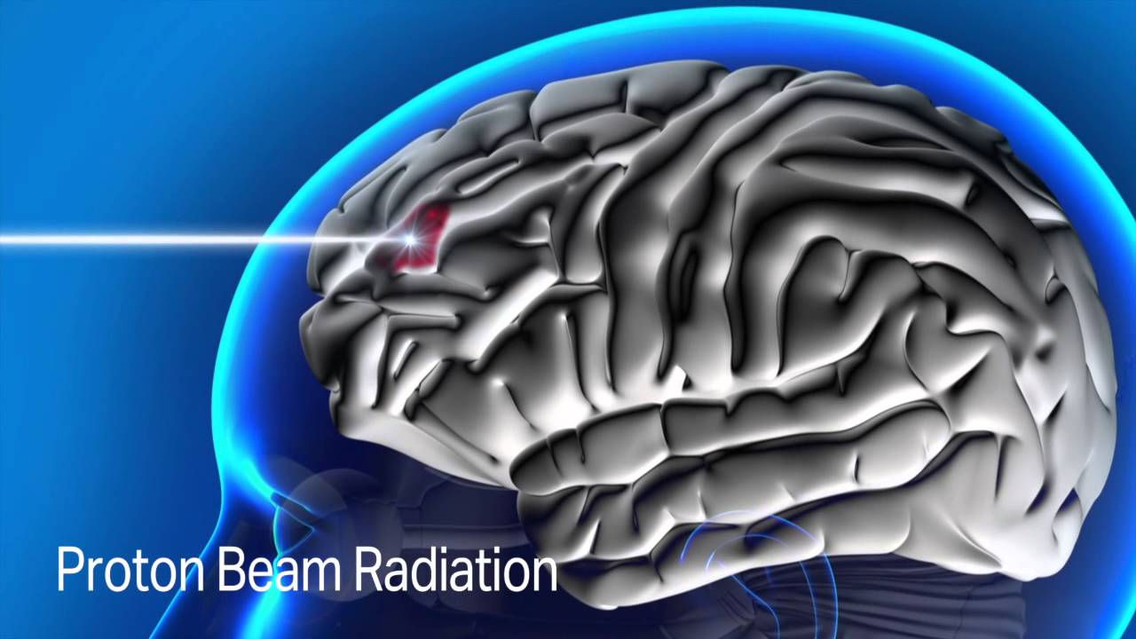 Proton Beam Radiation - YouTube