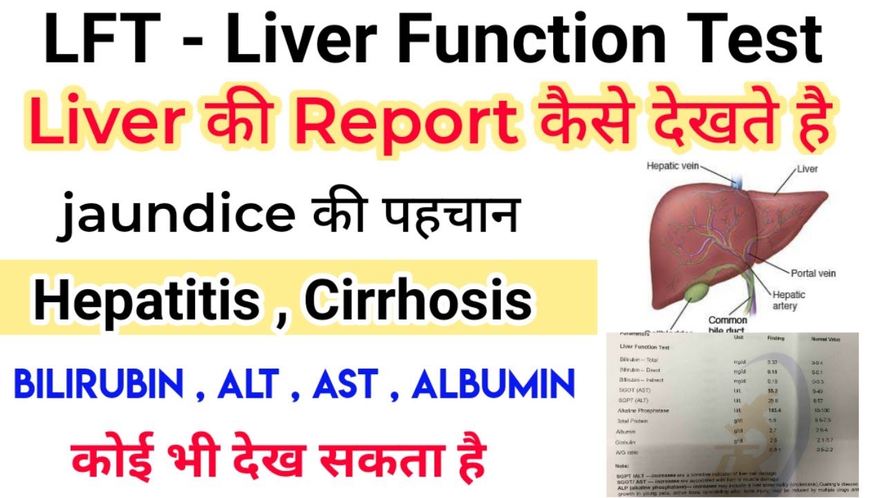 LFT - Liver function test - report कैसे देखे || AST , ALT , Bilirubin ...