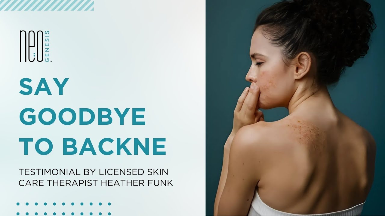 Say Goodbye to Backne: Testimonial by Licensed Skin Care Therapist ...