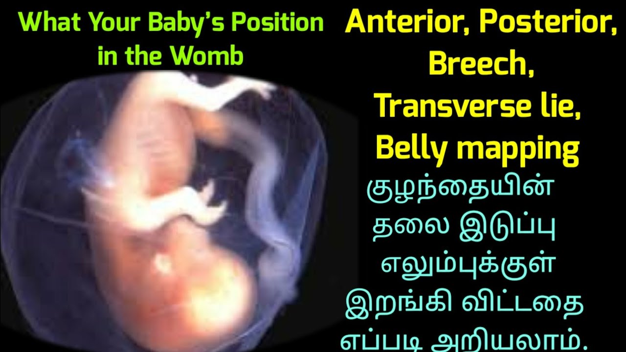anterior | positerior | transverse lie | belly mapping | breech | baby ...
