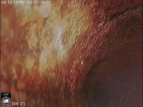 Unit 14 to 4th st - YouTube