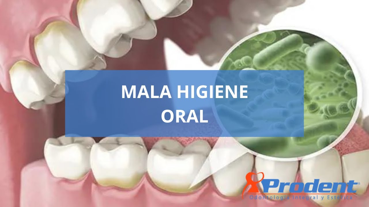 LA MALA HIGIENE ORAL 😐 - YouTube