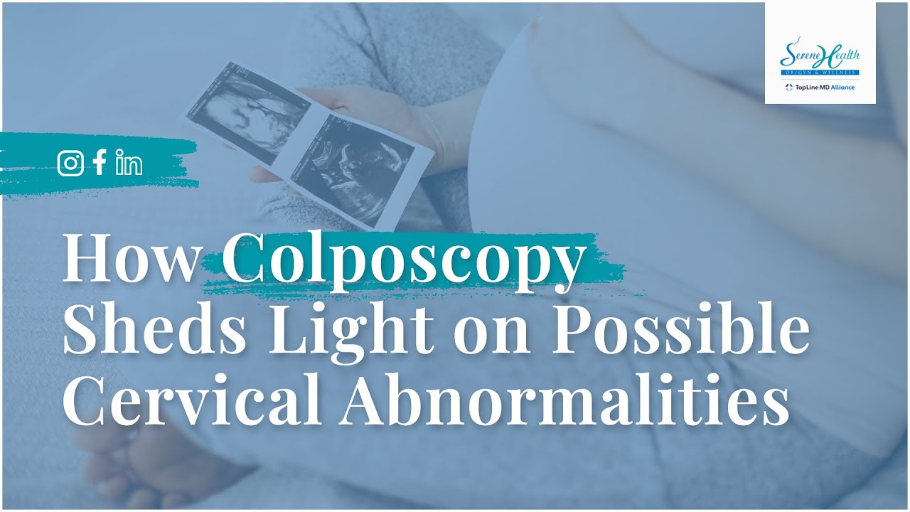 How Colposcopy Sheds Light On Possible Cervical Abnormalities - YouTube