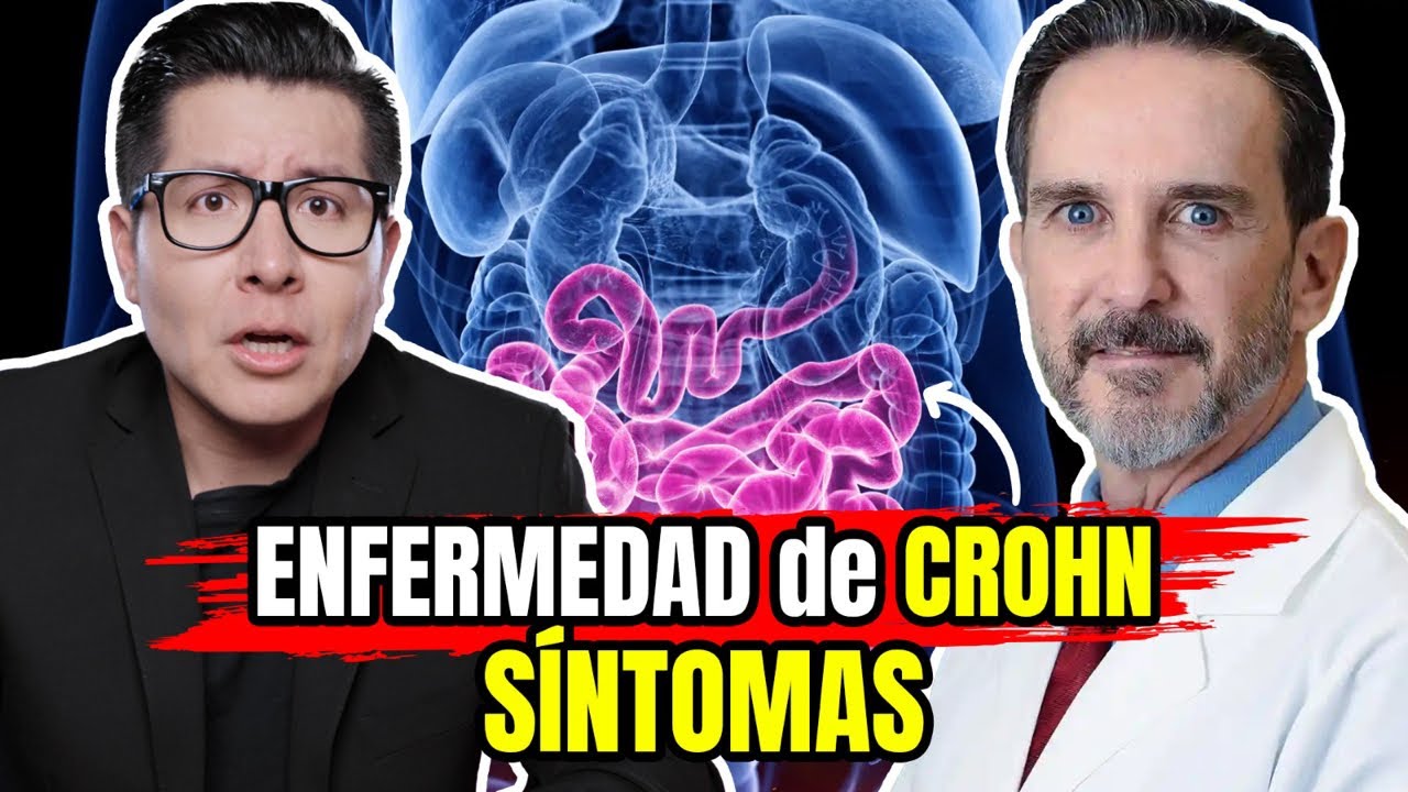 ENFERMEDAD de CROHN: Así se CONTROLA según ESPECIALISTA | Mr Doctor ft ...