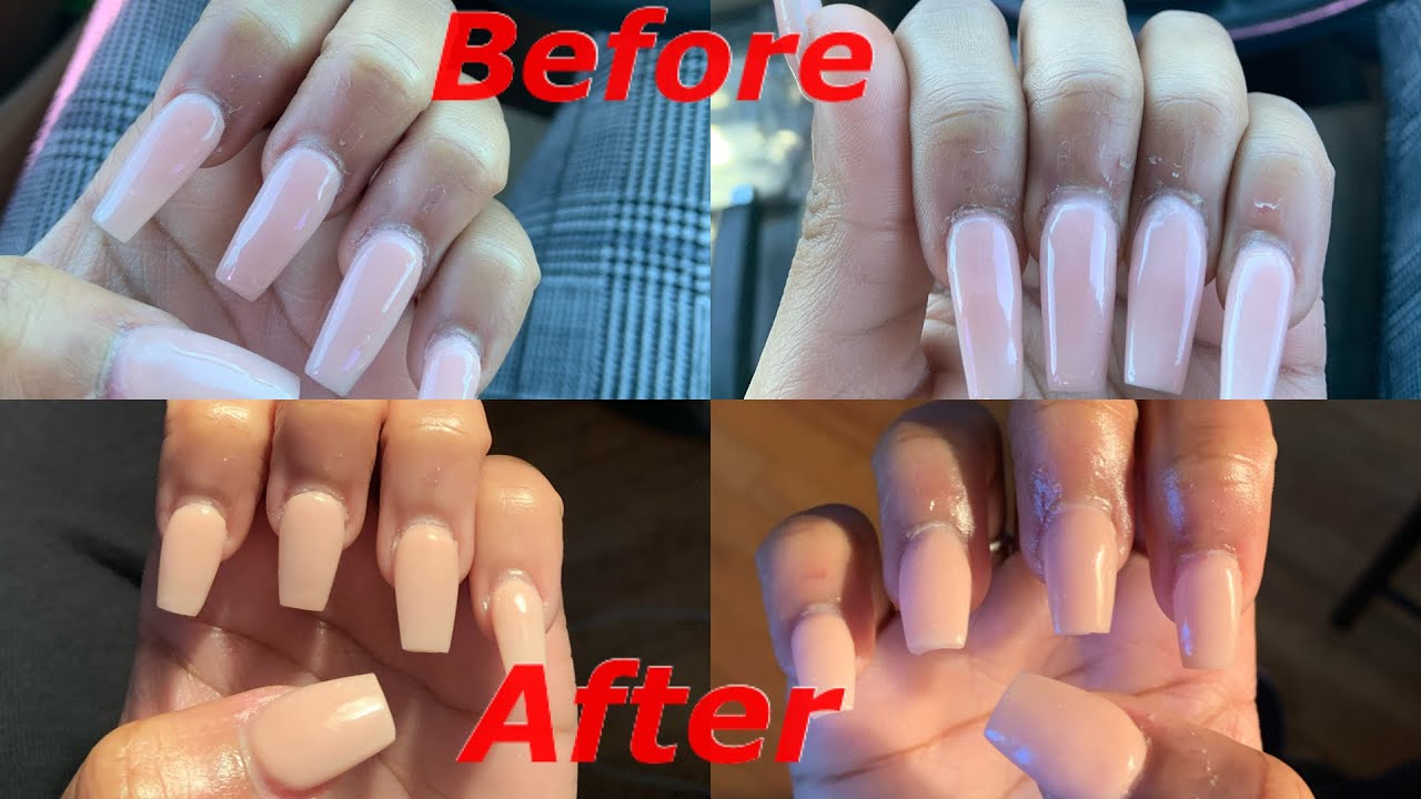The SECRET🤫 To Healing Damaged Cuticles in 5 days🤢 ️😍 - YouTube