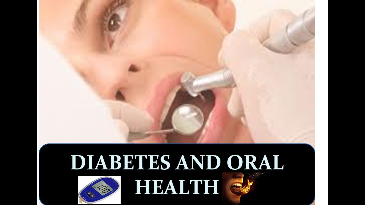 Diabetes and Oral Health I Diabetes Mellitus IDental Guide I Dr. Bimal ...