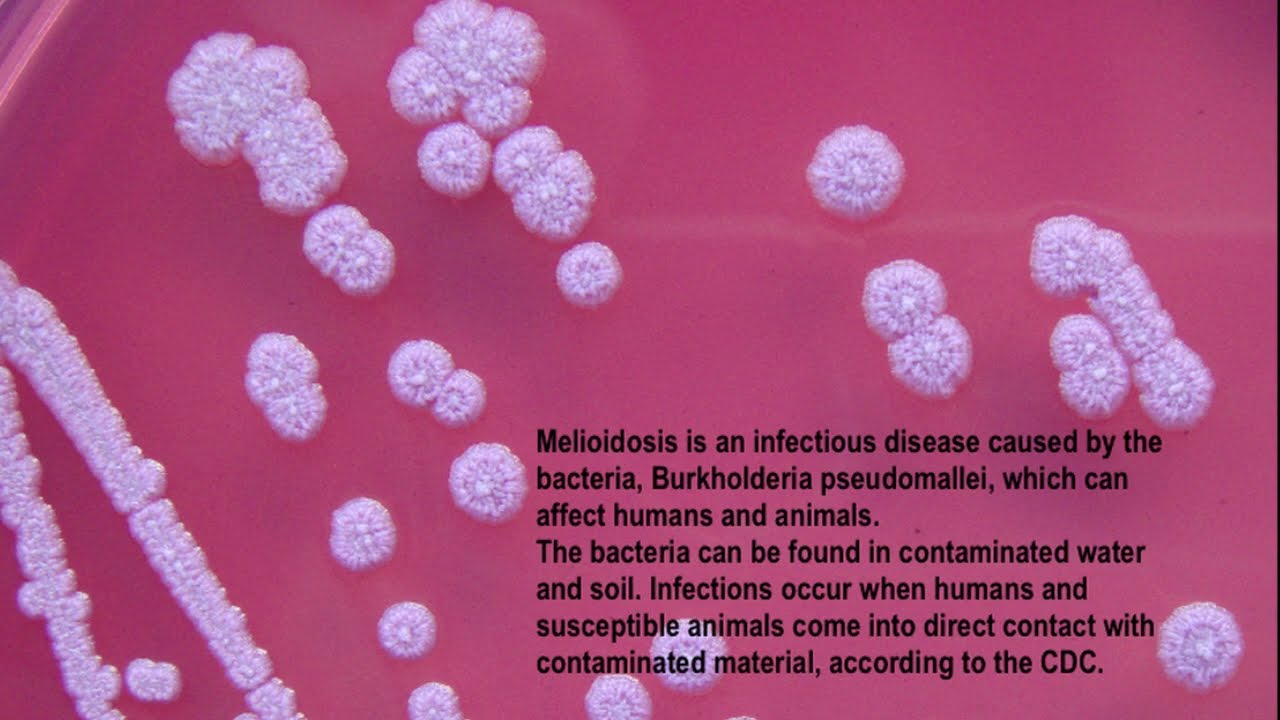 What is Melioidosis? Whitmore’s disease (Burkholderia pseudomallei aka ...