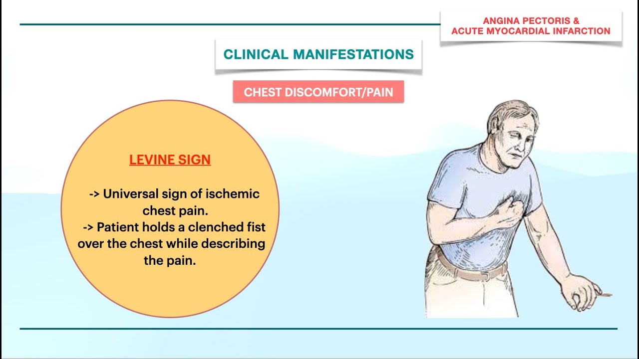 Chest pain (Angina Pectoris & Myocardial Infarction) | Medical ...