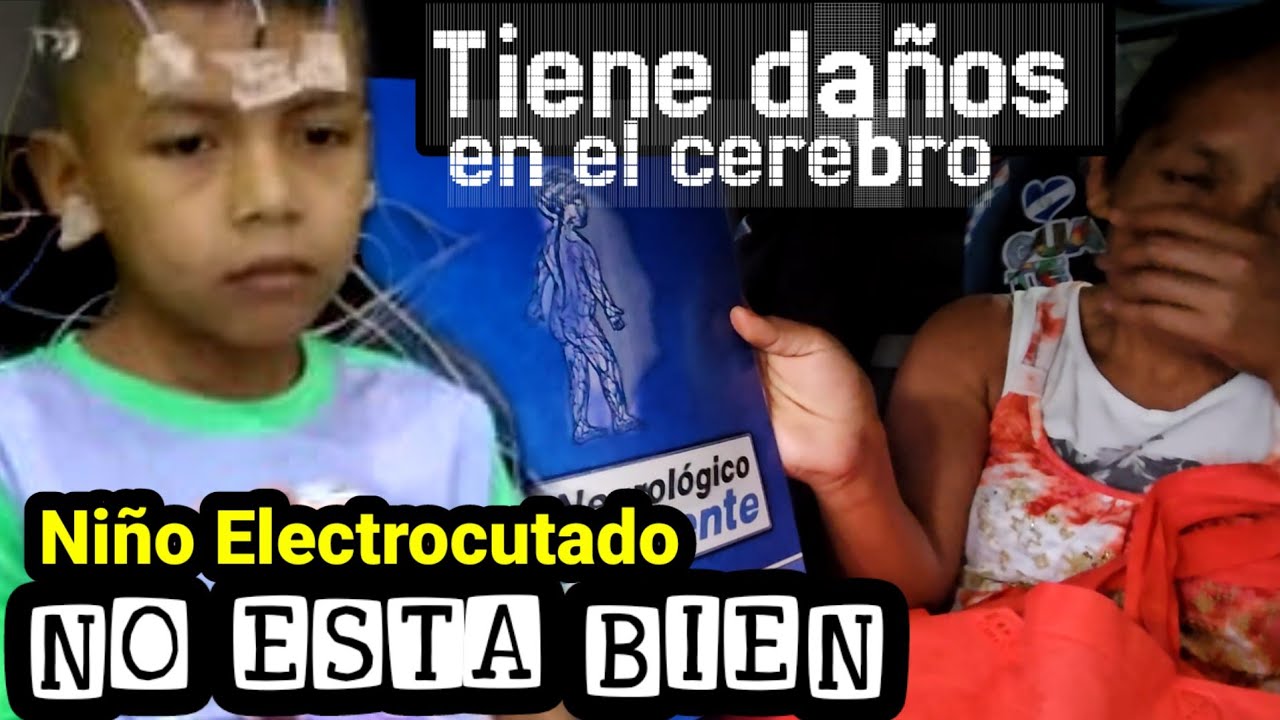 Niño Electrocutado PRESENTA ANOMALÍAS EN SU CEREBRO. YA TENEMOS EN ...