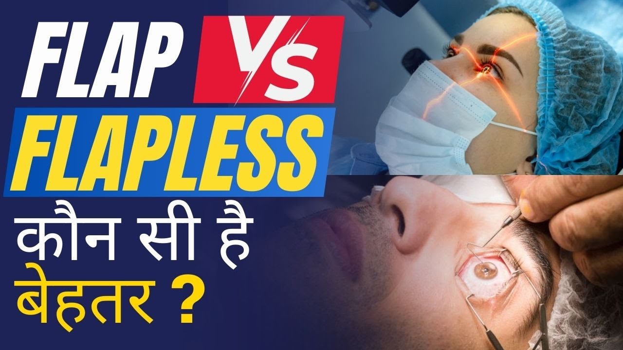 Which Surgery is Best - Flap Or Flapless Lasik? - YouTube