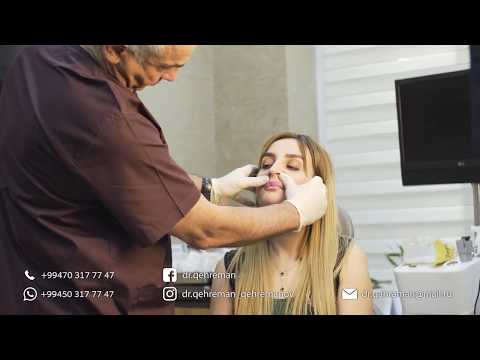 Dr. Qəhrəman Qəhrəmanovun tanıtım çarxı