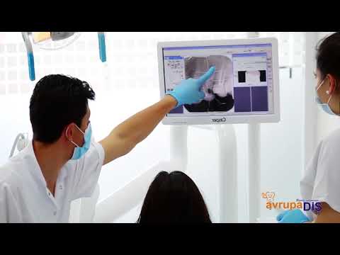 Implant Tedavisinde uzman. AvrupaDİŞ