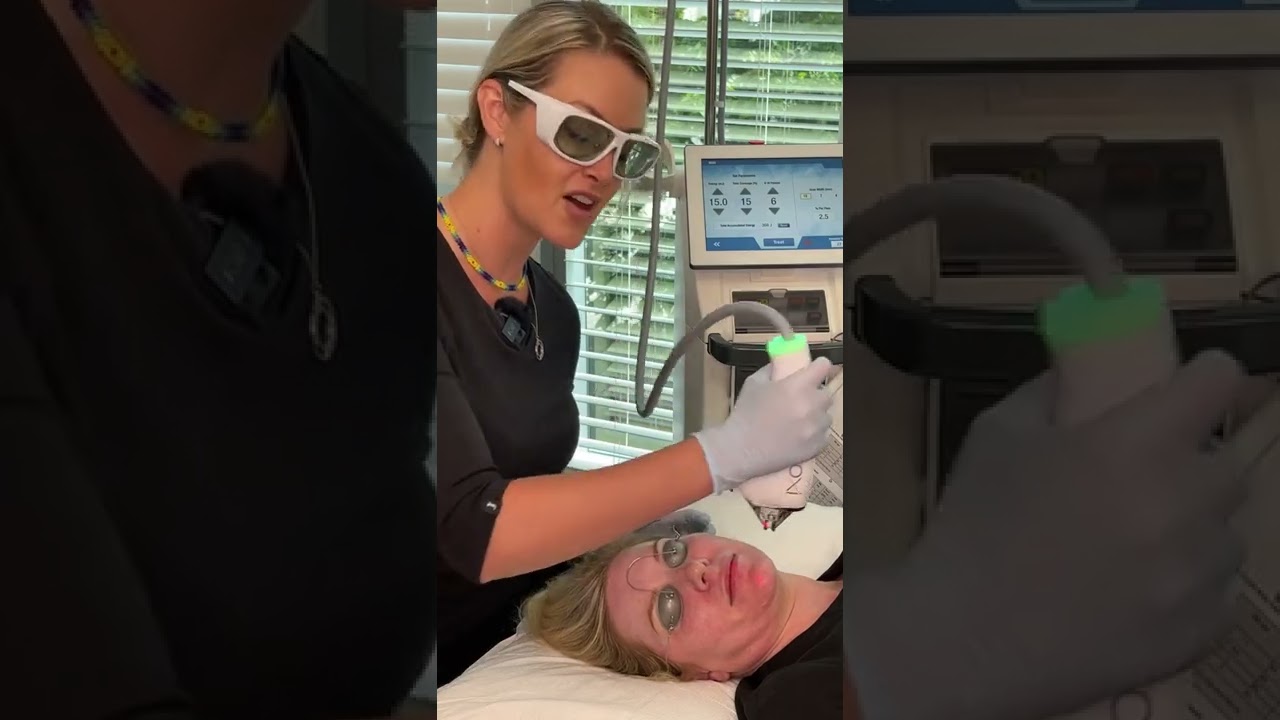 MOXI Laser Treatment Demo - YouTube