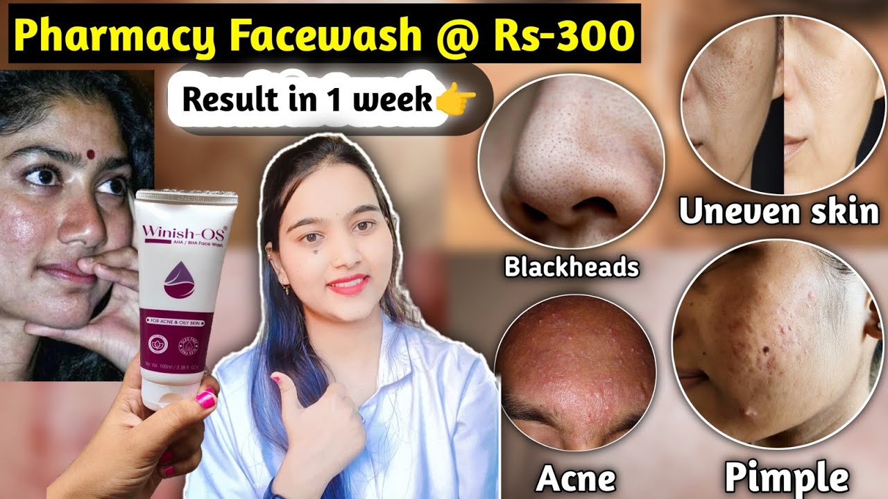 Skin brightening Facewash that treats Acne, Pimple, pigmentation ...