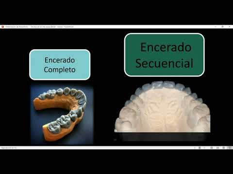 Técnica de los 3 pasos de Dra. Vailati. Clase ERO 2020 Dr. Scherer