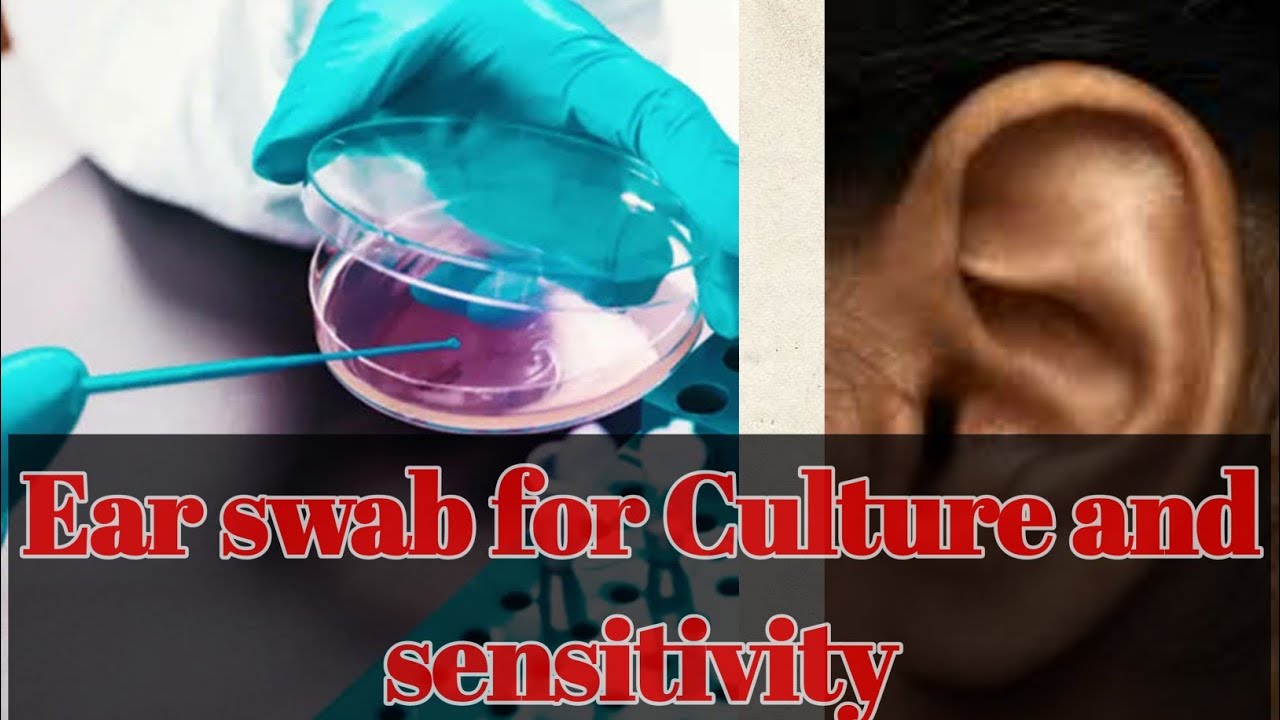 Ear Swab for Culture and sensitivity (C/S) test - YouTube