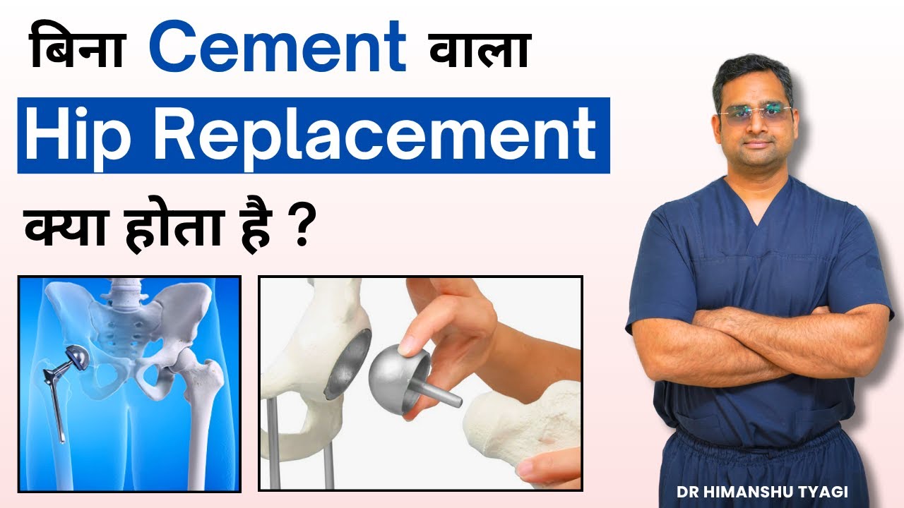 बिना Cement वाला Hip Replacement ? | cementless hip replacement (THR ...