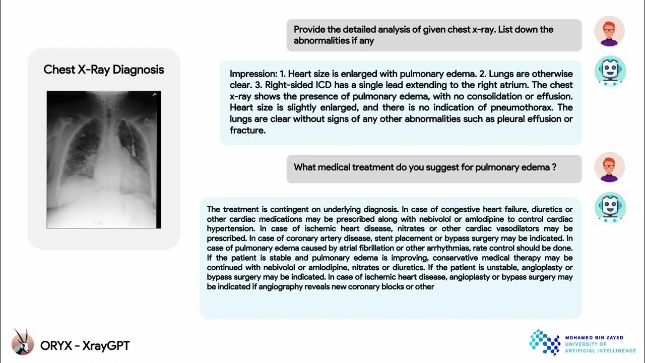 Xraygpt Chest Radiographs Summarization Using Medical Vision Language Models Youtube
