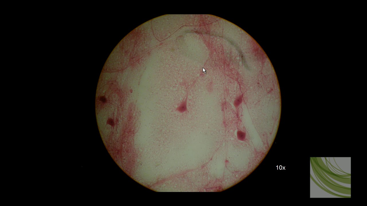 SLIDE: Neuron Smear - YouTube