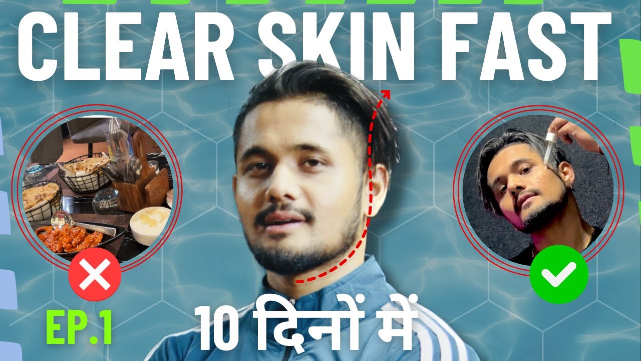 10 दिनों में CLEAR & FAIR SKIN | Get Clear & Fair Skin Fast | EPISODE 1 - YouTube