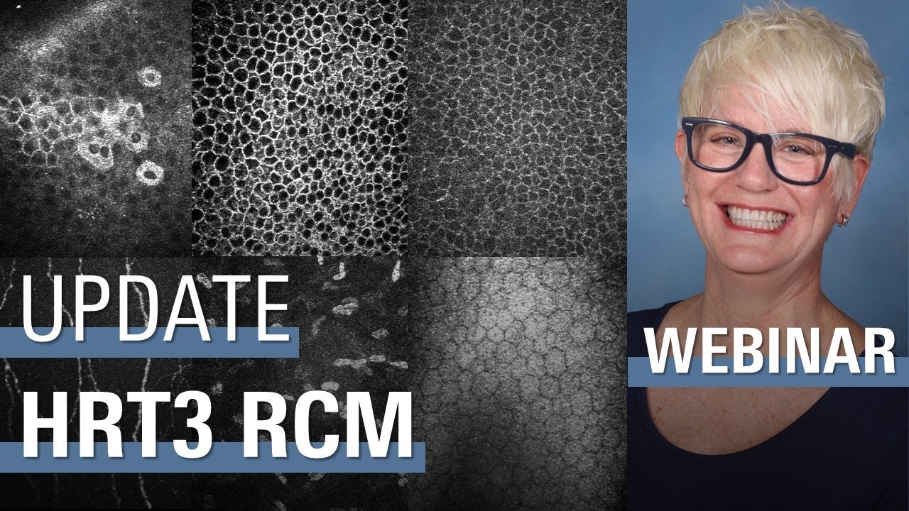 Update Corneal Microscopy | HRT3 RCM - YouTube