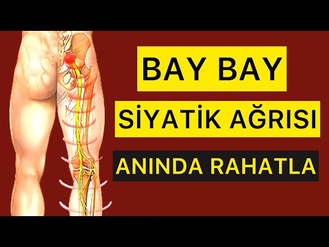 Priformis Ağrısından KALICI Olarak Nasıl Kurtuluruz? #siyatiksinir #priformissendromu