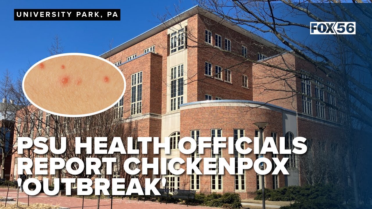 Penn State health officials report chickenpox 'outbreak' at University ...
