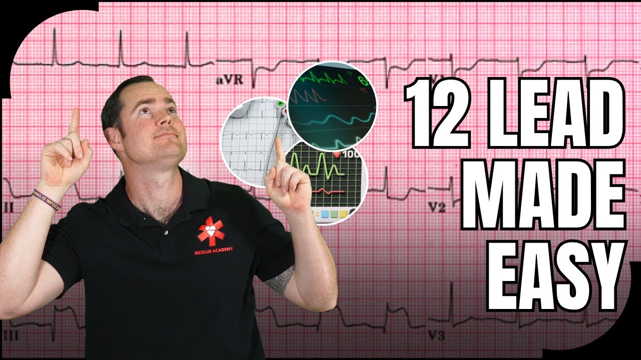 Master 12-Lead ECG Interpretation in 1 video - YouTube