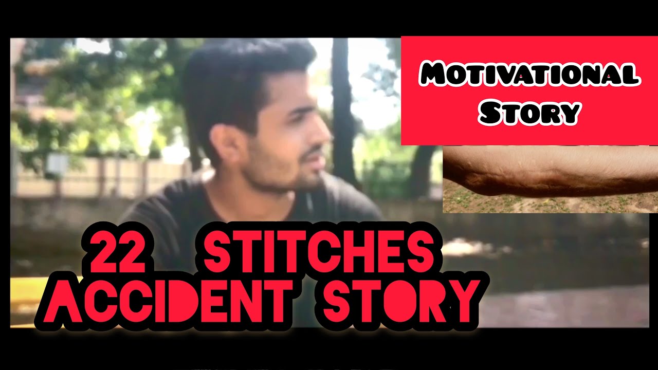 22 Stitches Accident|Motivational story| - YouTube
