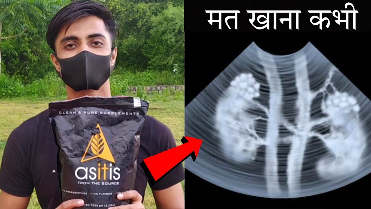 ASITIS Side Effects | हो गया खुलासा इस सस्ते ब्रांड का | Asitis Review ...