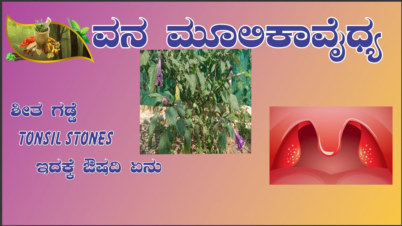 Tonsilstones In Throat Kannada YouTube tonsilstones-in-throat-kannada-youtube