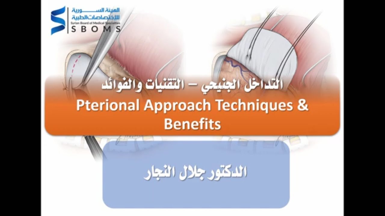 التداخل الجنيحي – التقنيات والفوائد || Pterional Approach Techniques ...